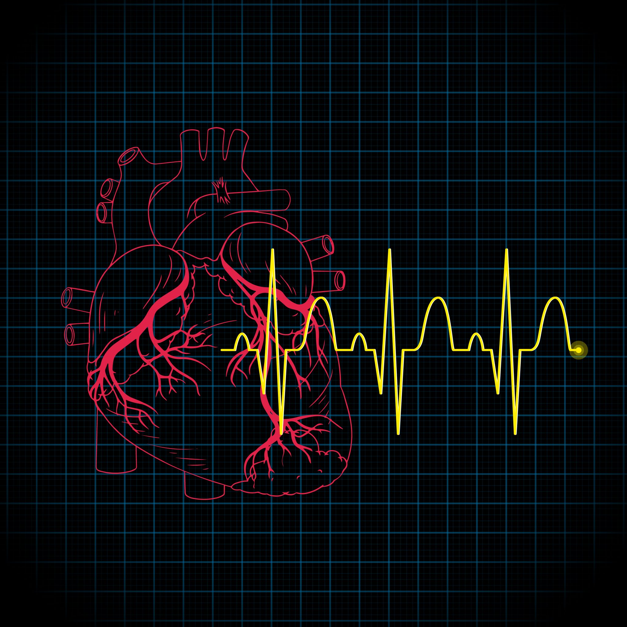 Better Heart Attack Detection With the New AI Tool - eMedNews