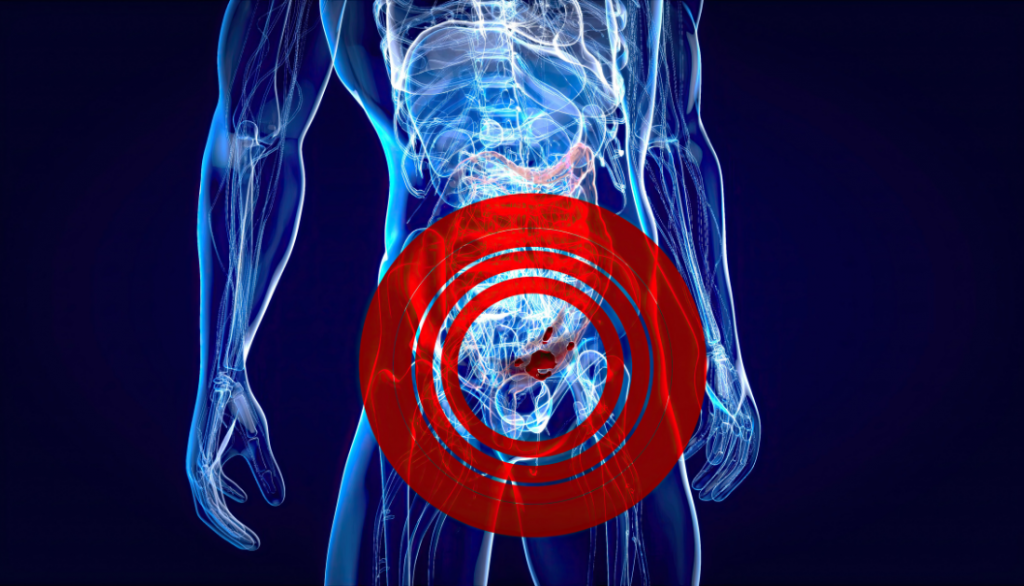 Promising Results of Total Neoadjuvant Therapy in Advanced Rectal ...
