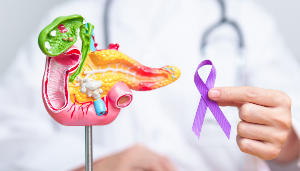 Epigenetic Target Boosts Pancreatic Cancer Therapy - eMedNews